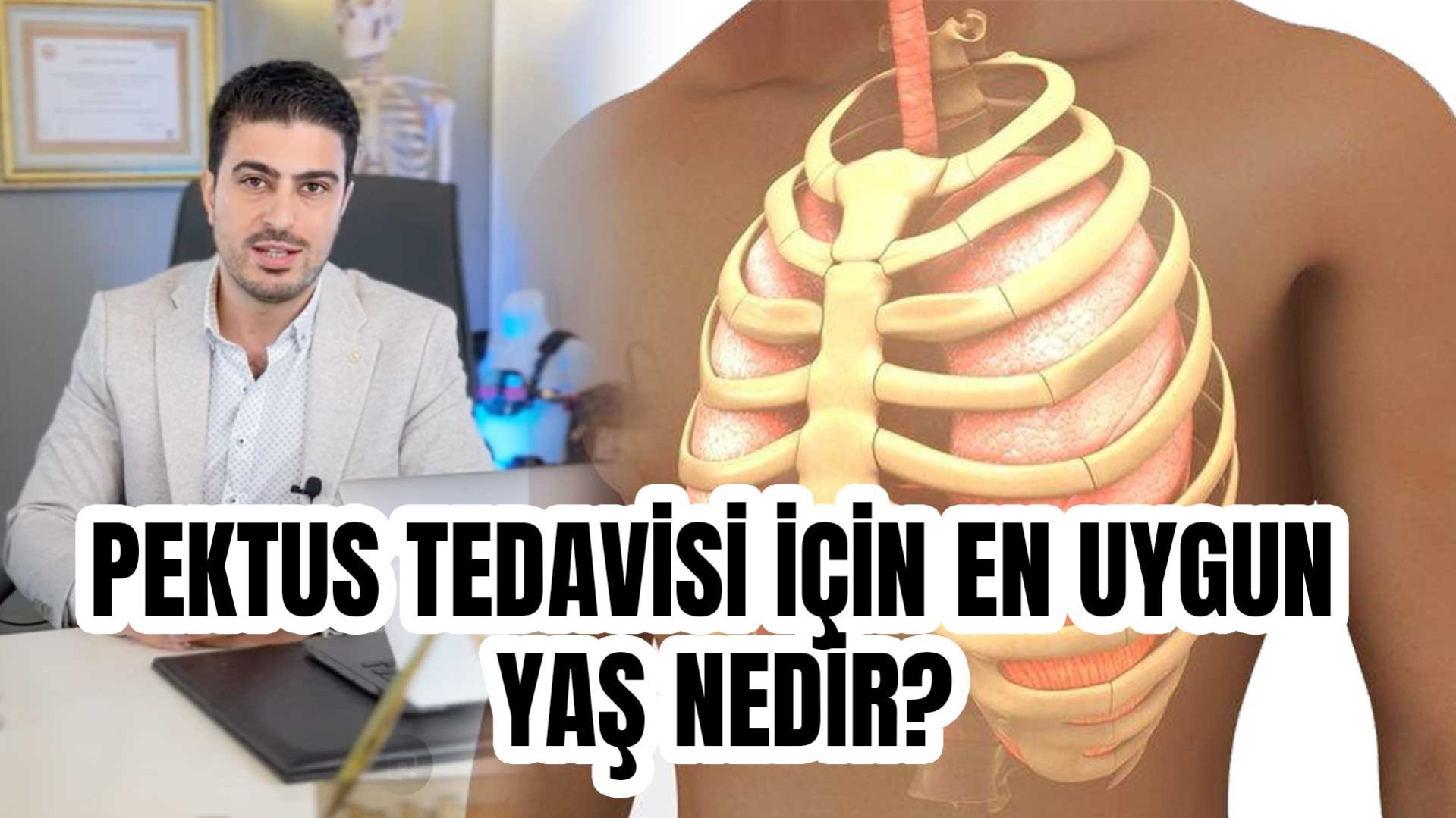 Pektus Tedavisi İçin En Uygun Yaş Nedir? - Doç. Dr. Hasan Ersöz | Doç ...